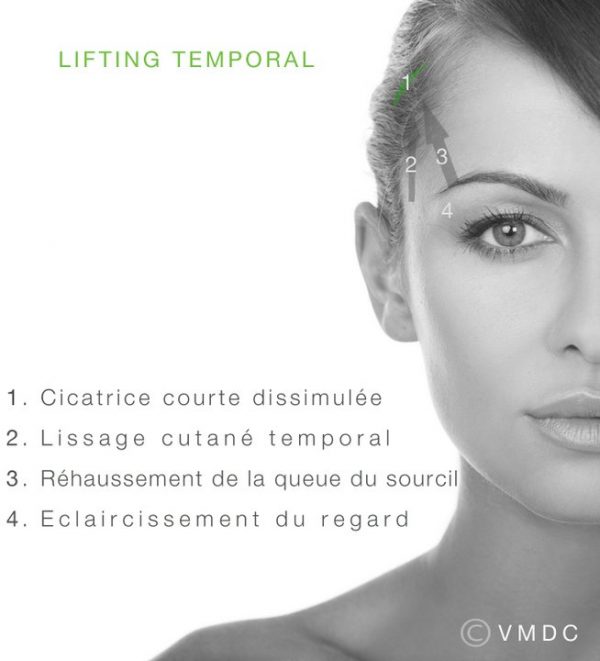 Lifting temporal à Cannes | Dr Médard de Chardon