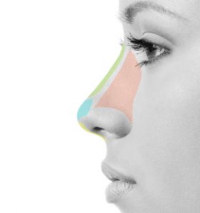 Rhinoplastie médicale - Cannes | Dr Médard de Chardon